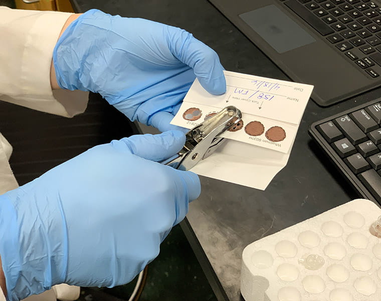 Experimental Blood Test Accurately Spots Fibromyalgia | Ohio State ...