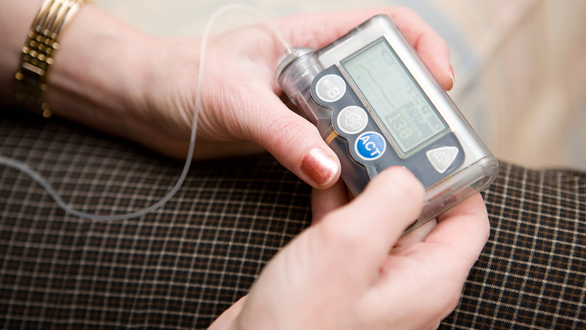 The 5 Cs of choosing an insulin delivery method | Ohio State Wexner ...