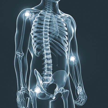 Orthopaedic Care | Ohio State Wexner Medical Center