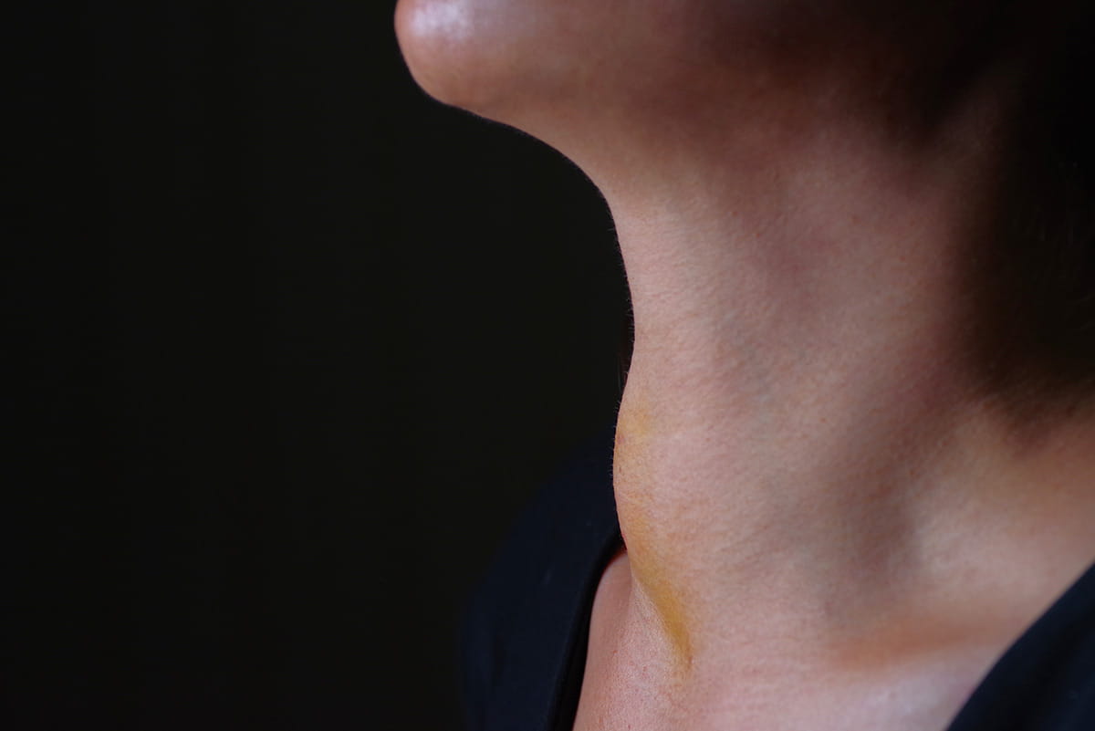 Thyroid Nodules | Ohio State Medical Center