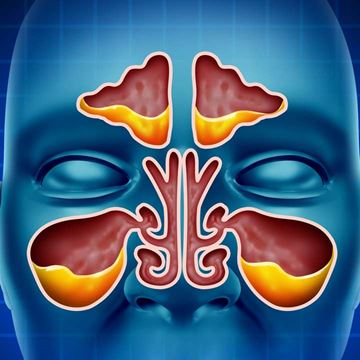 Sinus Conditions | Ohio State Medical Center